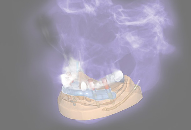 NATRODENT - Oficjalny partner i support Exocad. Szkolenia, wdrożenia ...